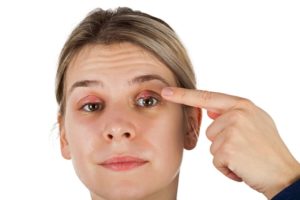 What Is a Stye and How Should You Deal with It?